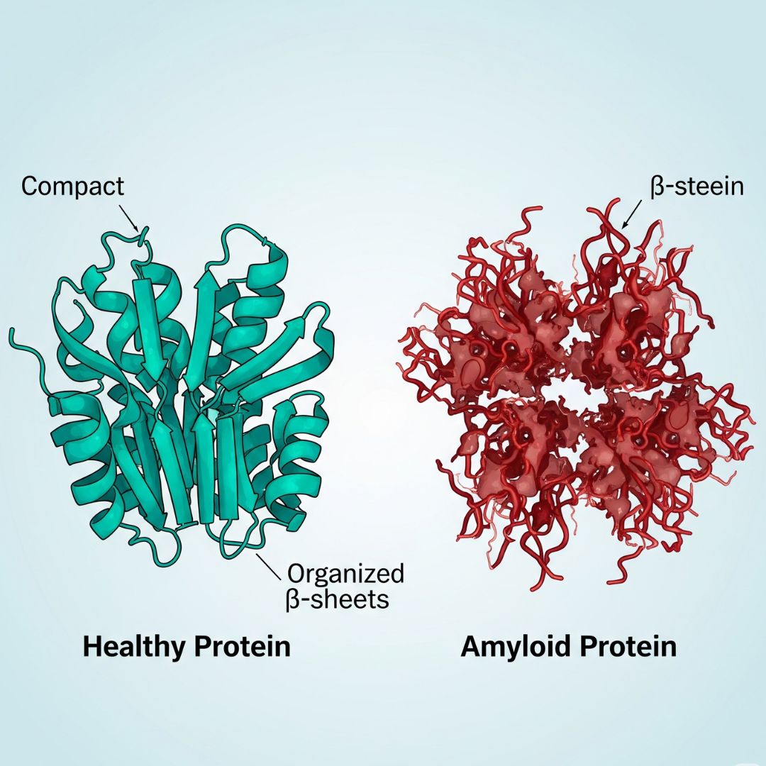 What Are Amyloid Proteins? - ASGI